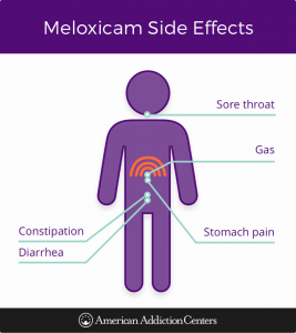 What Is Meloxicam & How Is It Abused? | Laguna Treatment Center
